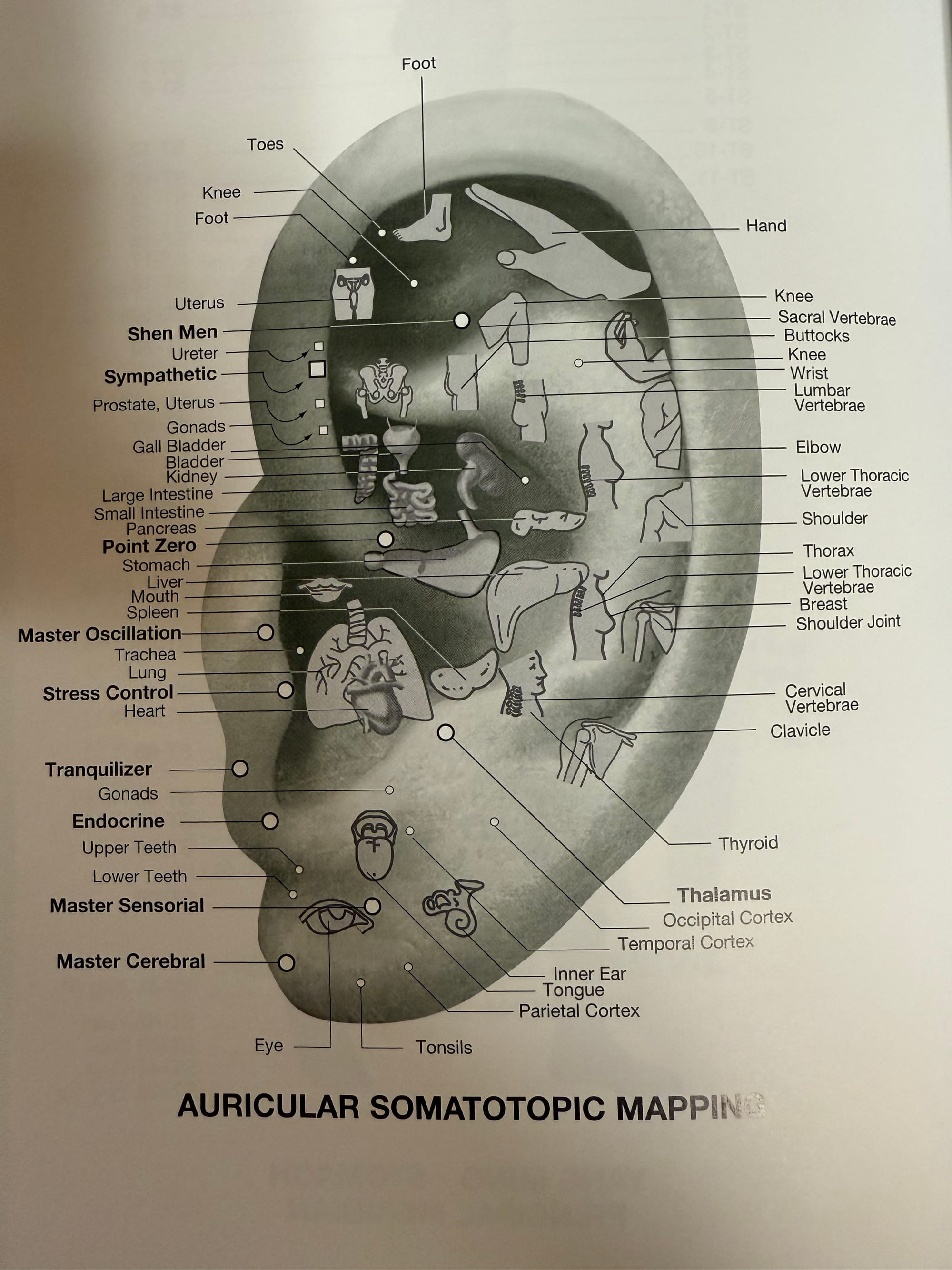 acupuncture vs dry needling